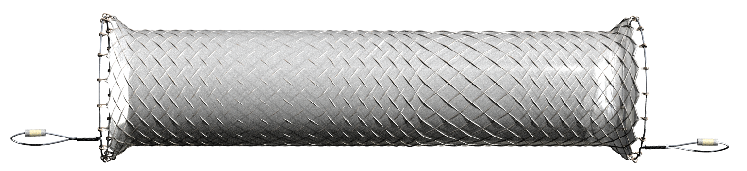 Comparación entre el uso de un balón para taponar el esófago y un stent ...